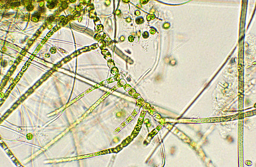 L’ALGUE OSTREOPSIS sous l’oeil du microscope - Les Petites Affiches 64